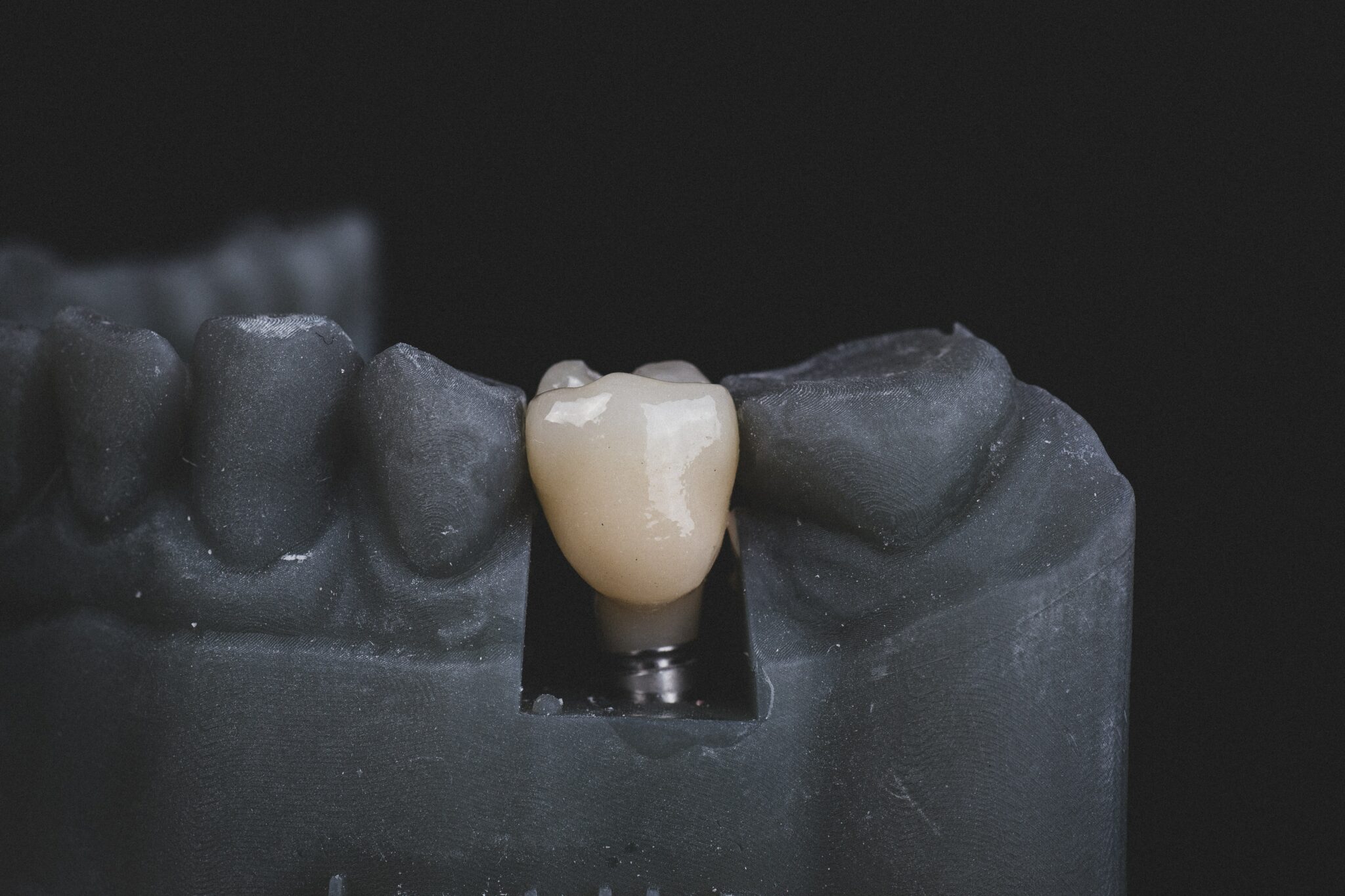 Services Arbor A Dental Concept Long Island City Dentistry